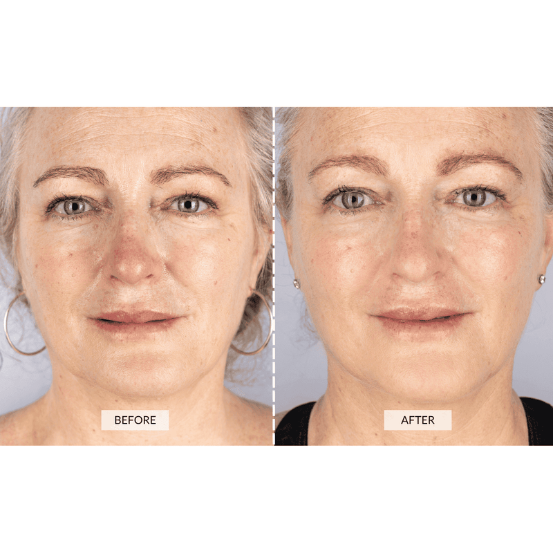 LED Maske | Lys Terapi Maske | CurrentBody Skin DK | CurrentBody DK